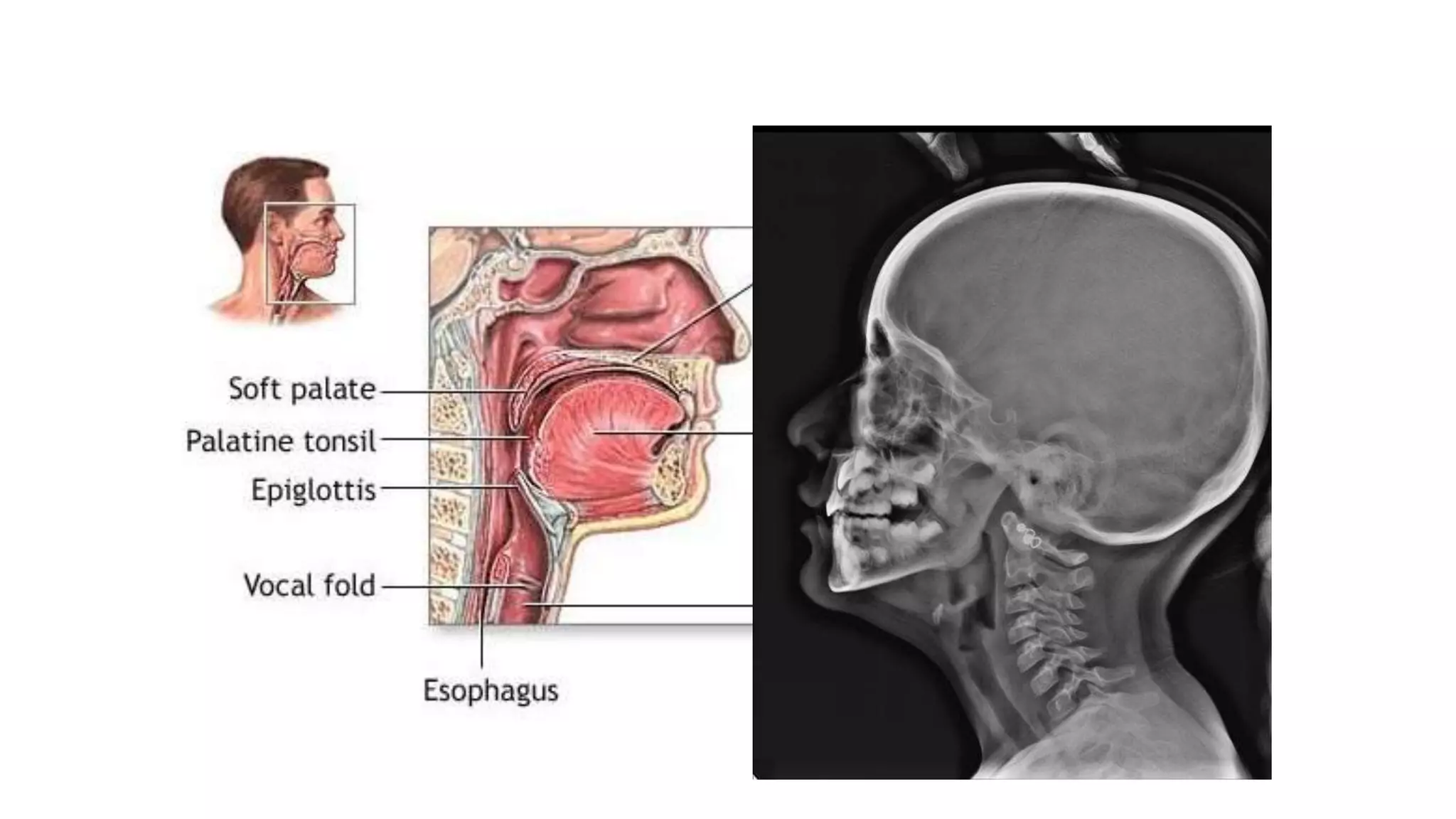 Anatomy of Larynx.pptx