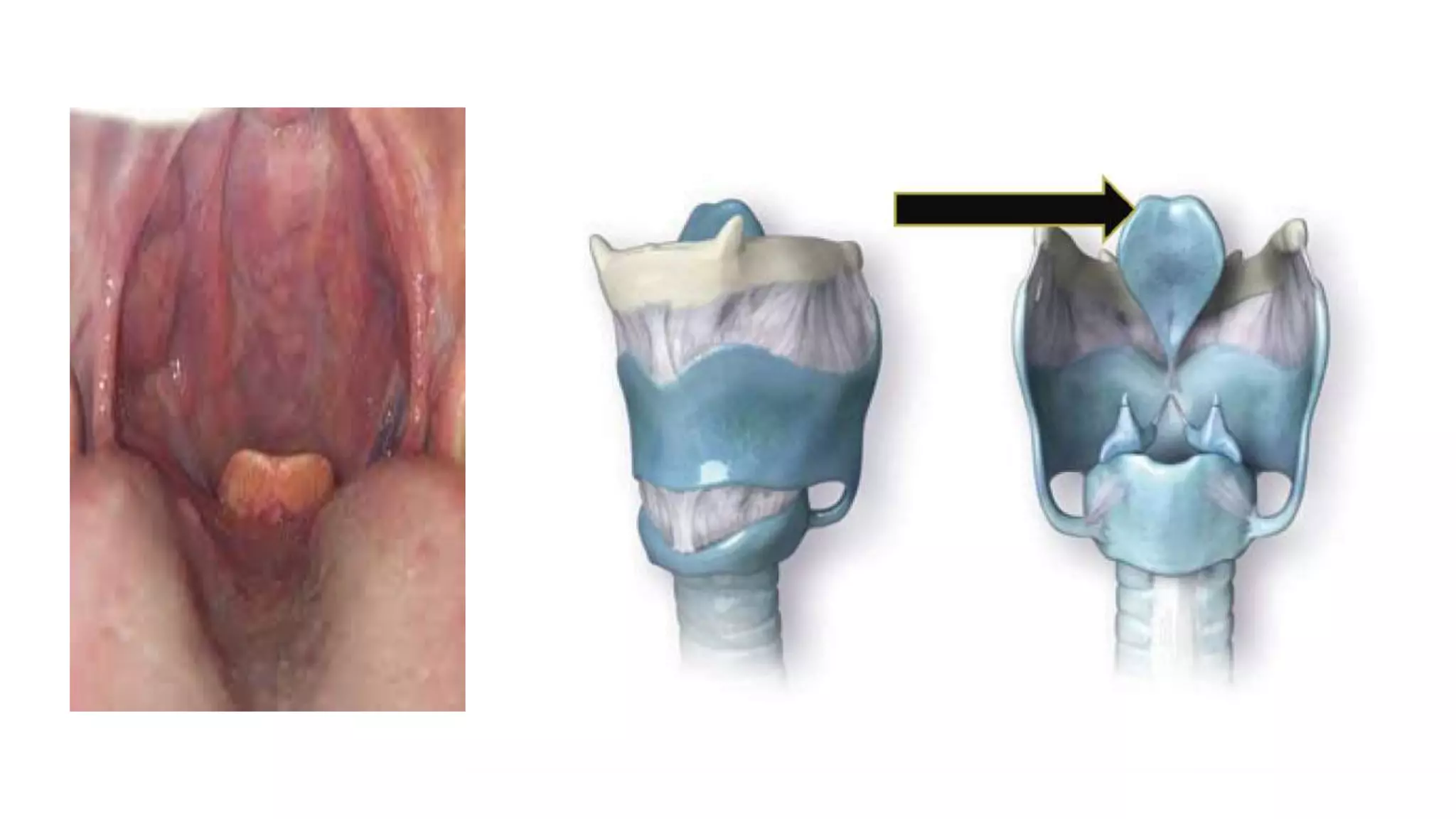Anatomy of Larynx.pptx