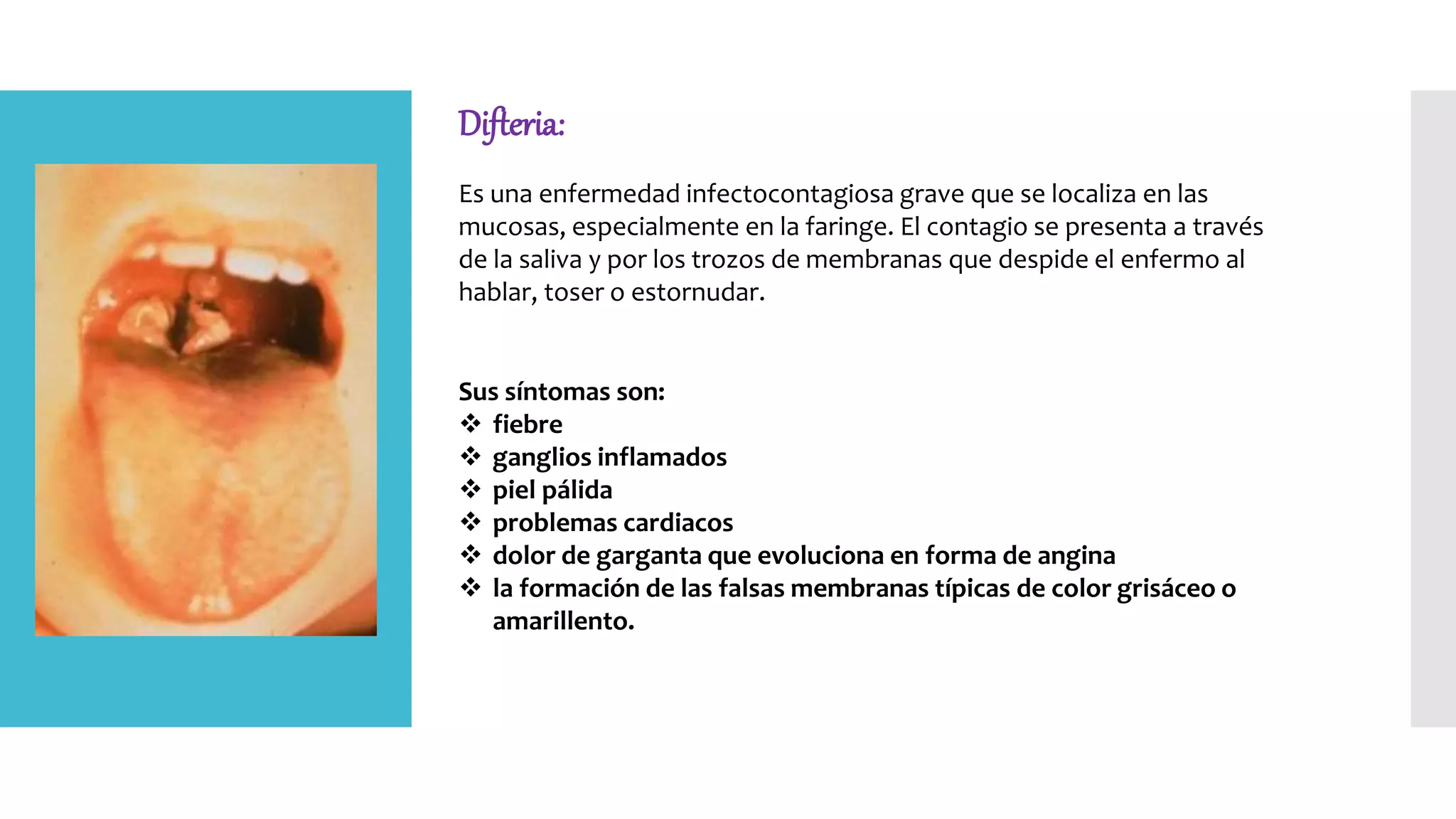 Las 10 enfermedades en los niños | PPTX