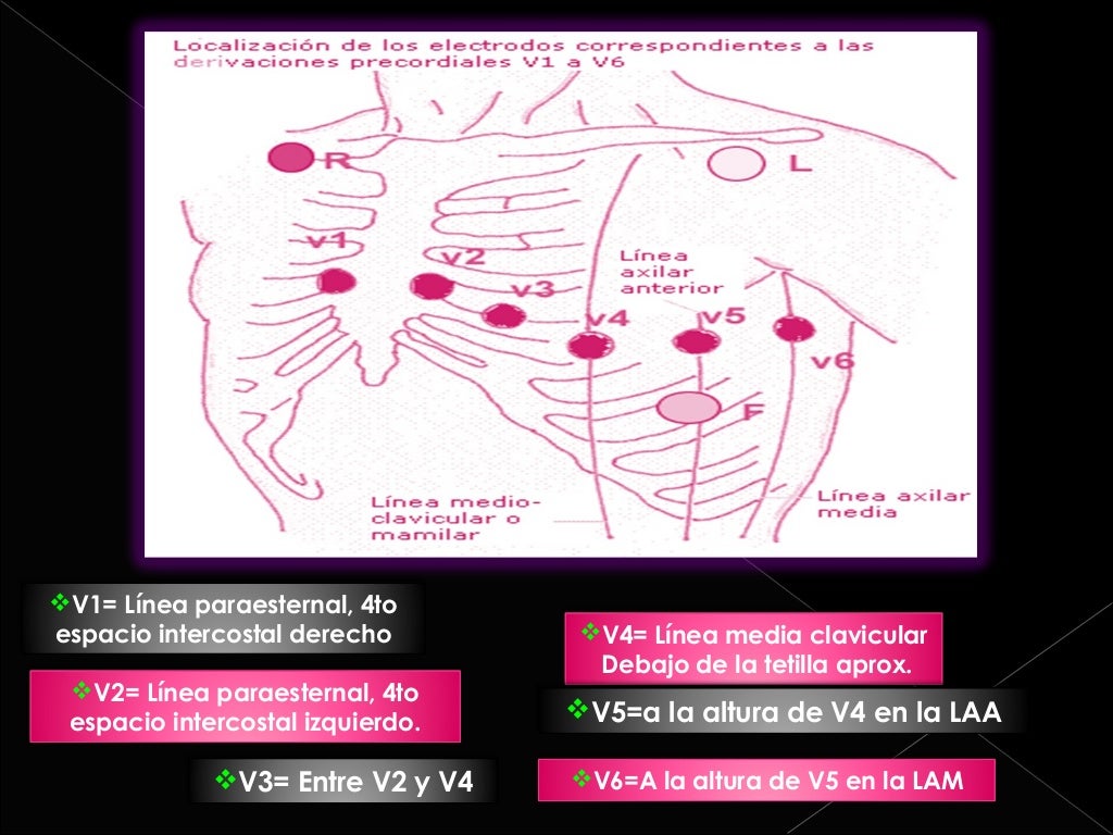 Las 12 derivaciones del electrocardiograma