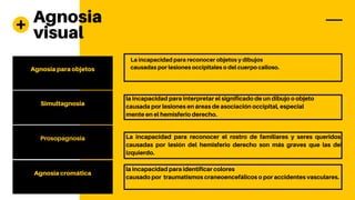 Las agnosias (1).pdf