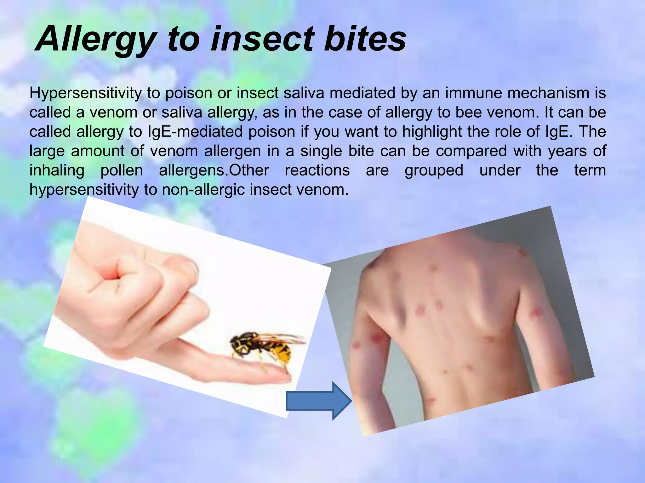 The allergies | PPTX