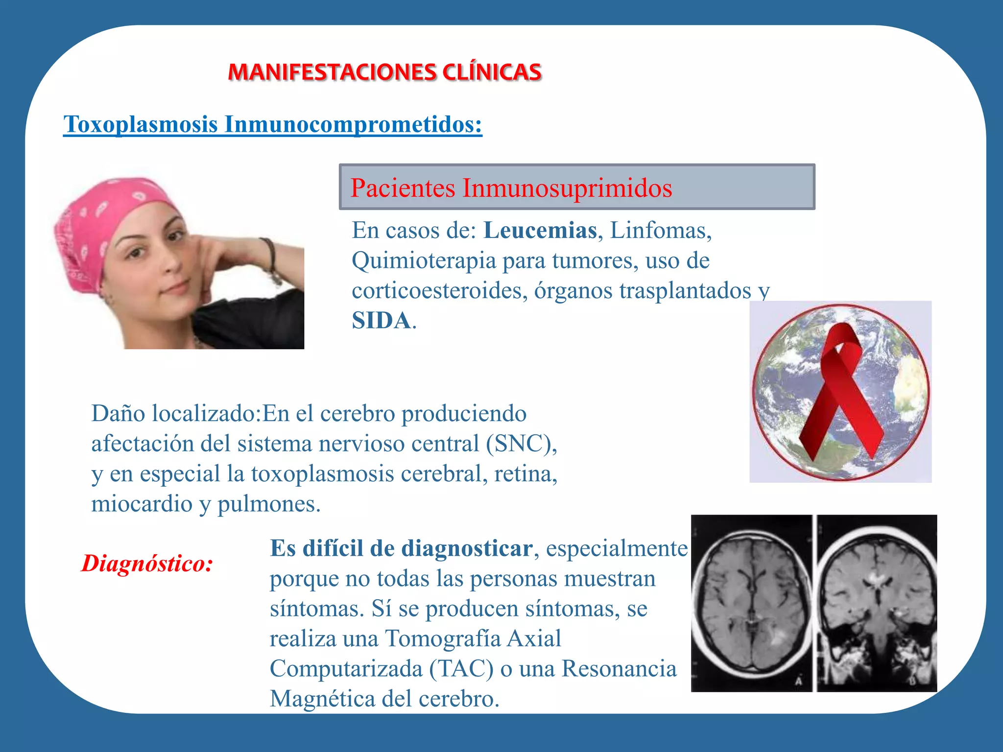 Toxoplasmosis, Criptosporidiosis y Isosporiasis en pacientes con sida ...