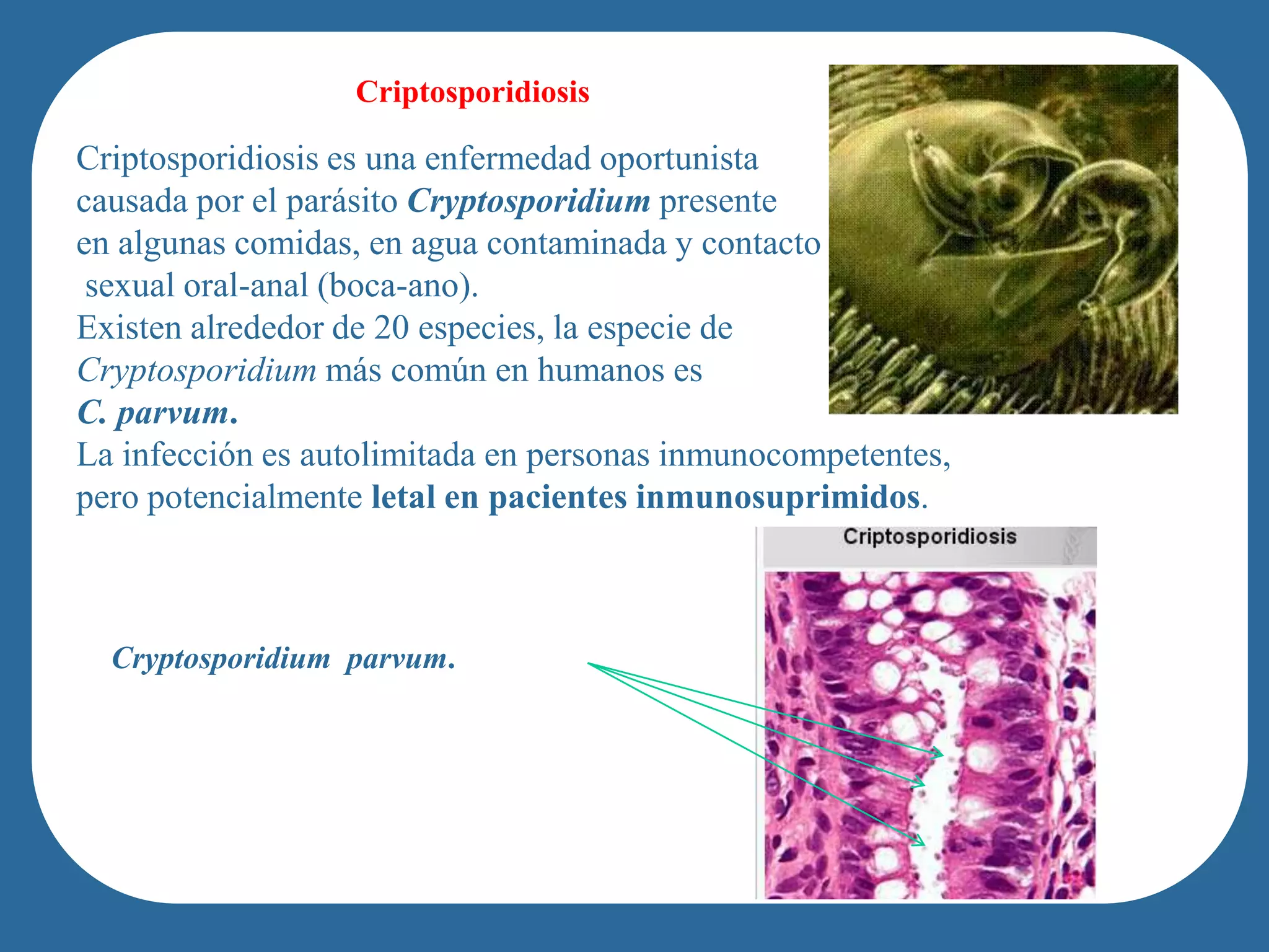Toxoplasmosis, Criptosporidiosis y Isosporiasis en pacientes con sida ...