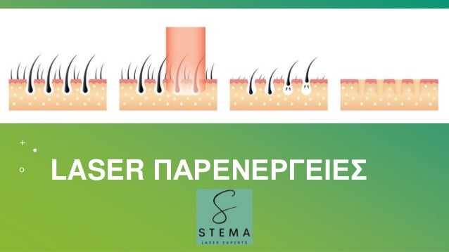 Laser παρενεργειες | PPTX