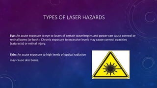 laser.pptx | Eye and Vision Conditions | Diseases and Conditions