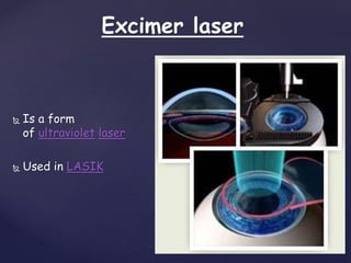 Uses of Laser light in human eye disorders pptx | PPT