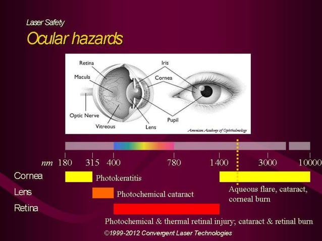 Uses of Laser light in human eye disorders pptx | PPTX | Eye and Vision ...