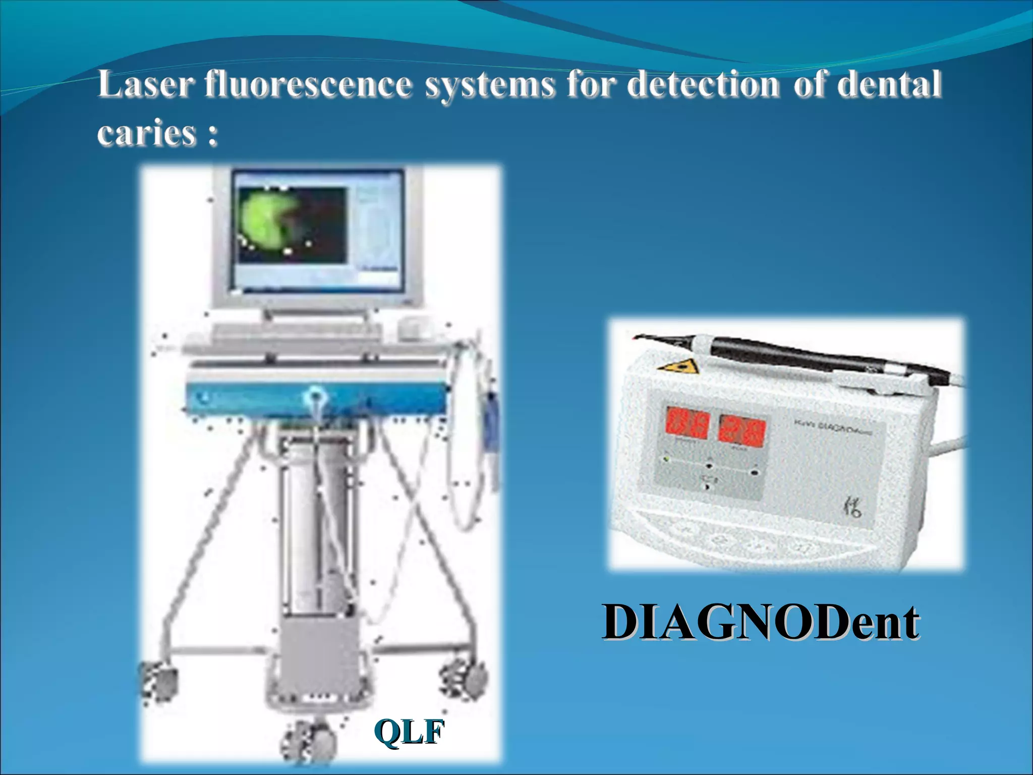 Laser Dental Hard Tissue Interaction With Possible Applications 2 Ppt