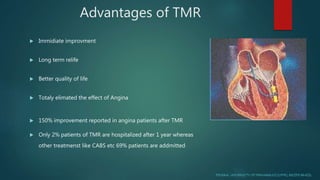 Laser used in cardiology maryam liaqat | PPTX