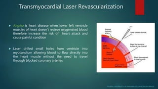 Laser used in cardiology maryam liaqat | PPTX