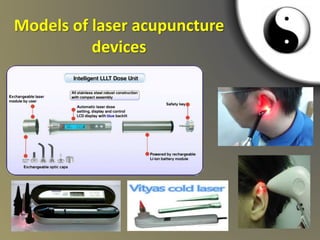 Laser acupuncture: Practical guidelines | PPTX