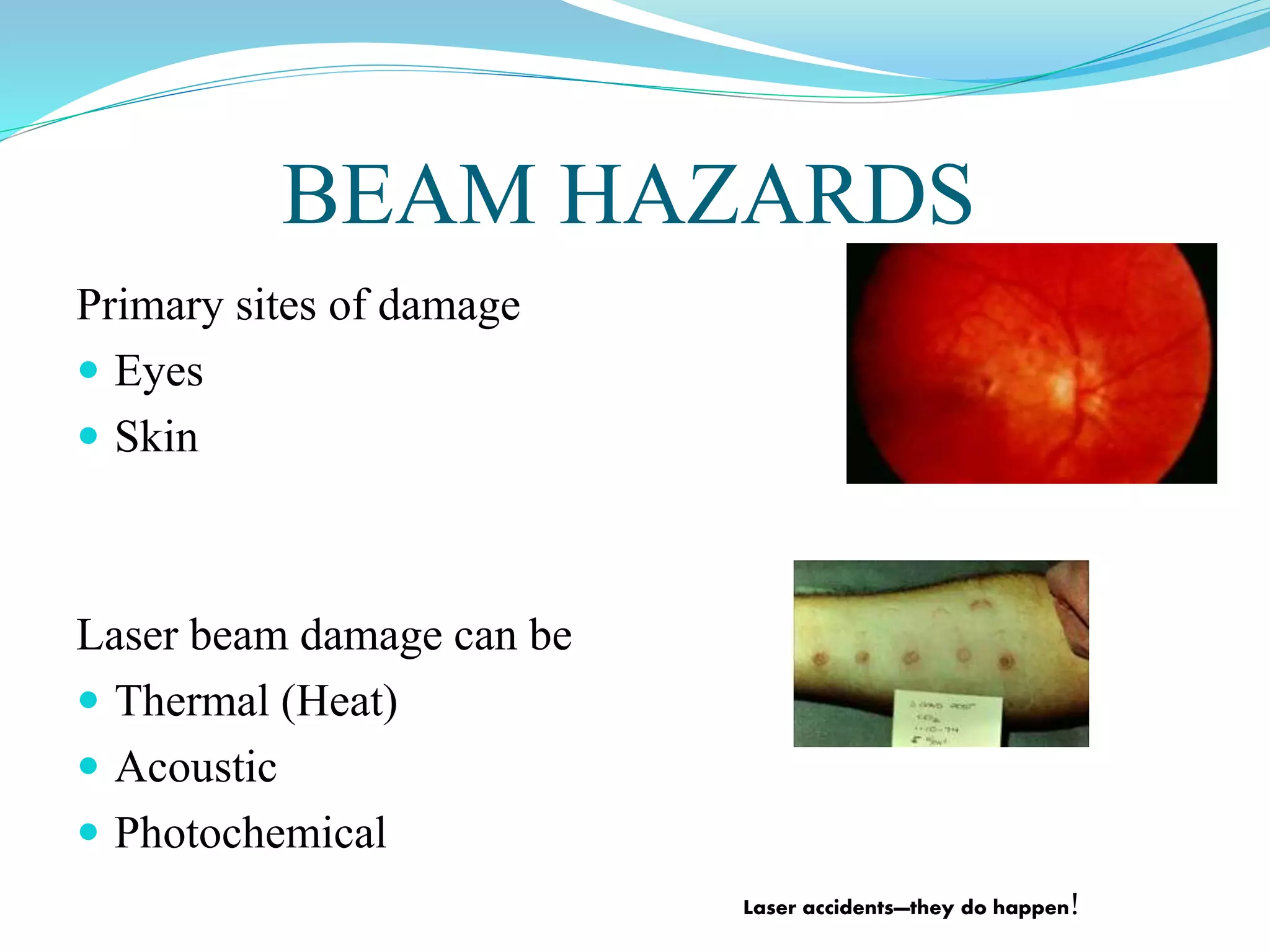 Laser and operating room safety | PPTX