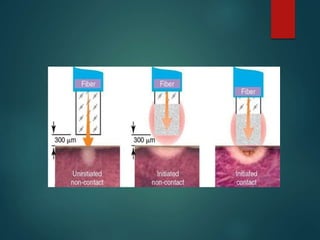 Diode Dental Laser Clinical Guide Clinical Guide For Soft Tissue
