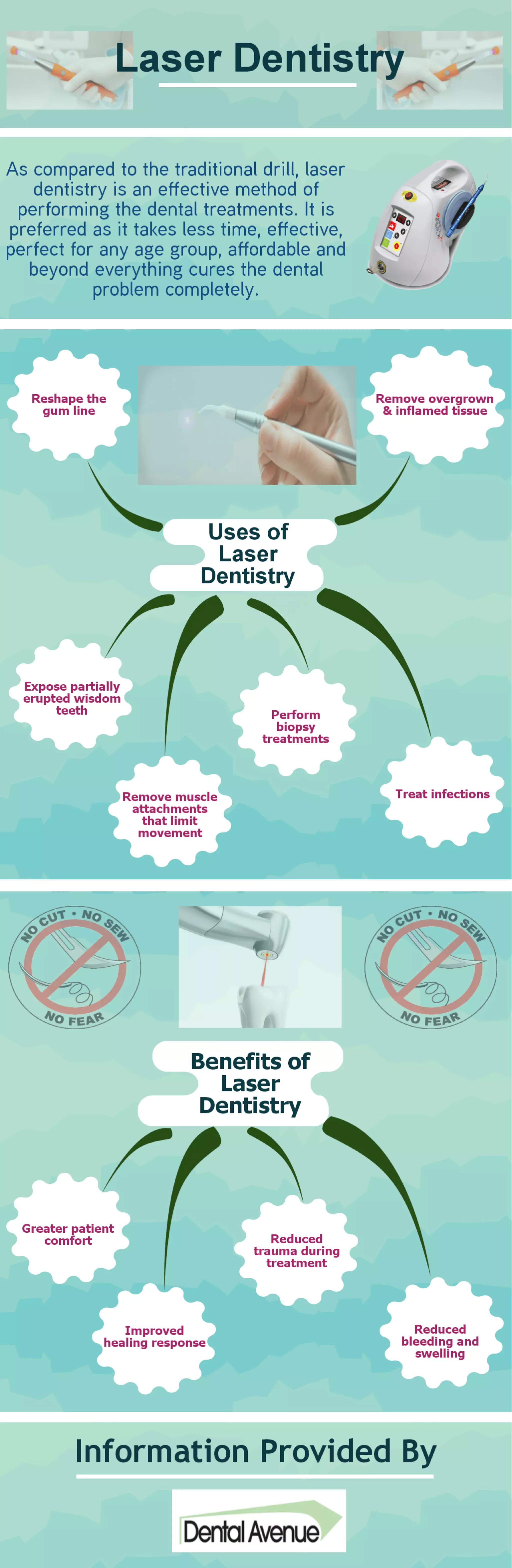 Laser Dentistry | PDF
