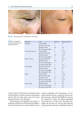 Laser dermatology | PDF