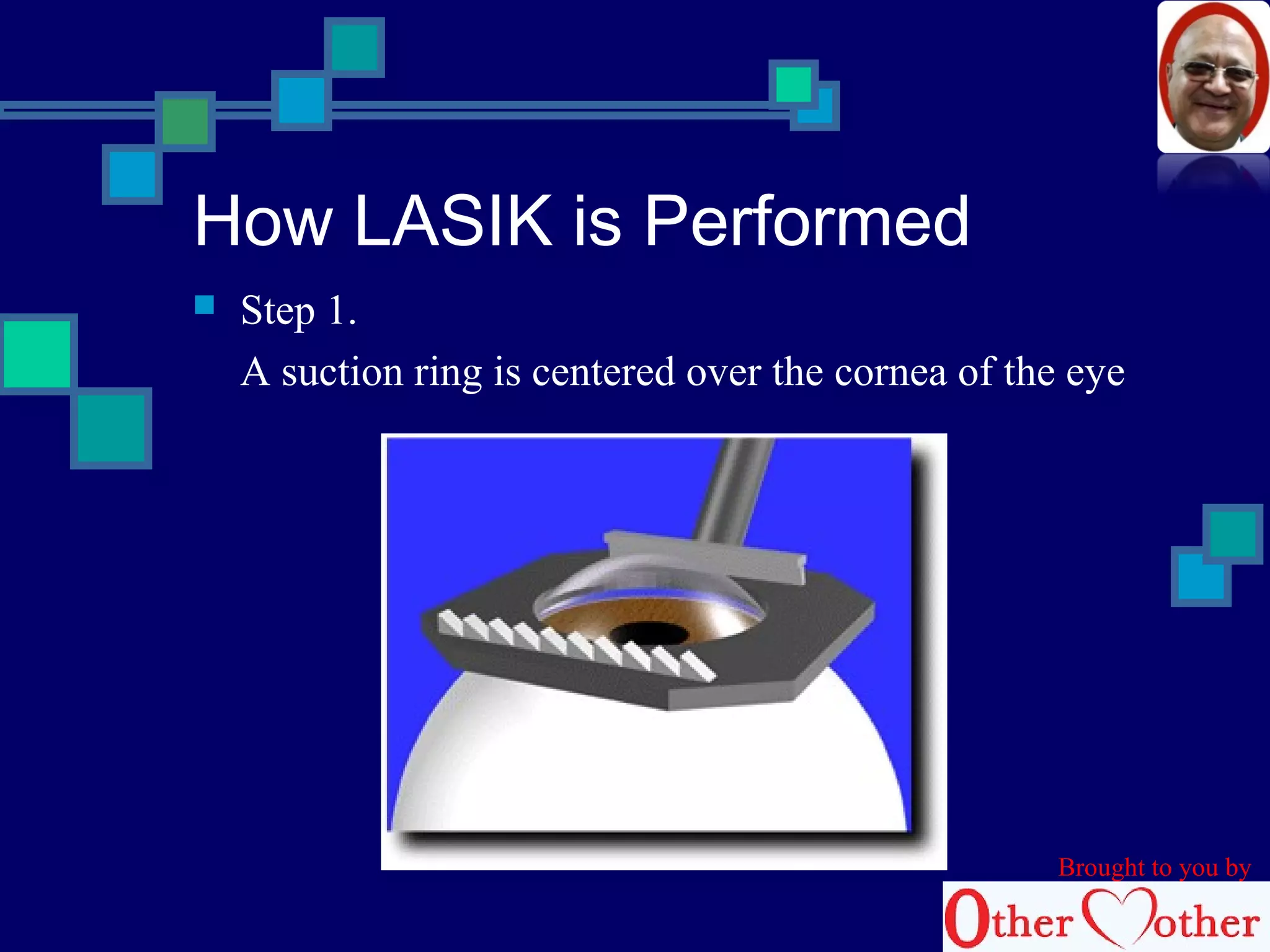 Laser eye surgery technology lasik | PPT
