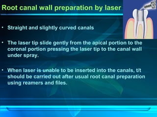 Laser in dentistry | PPT
