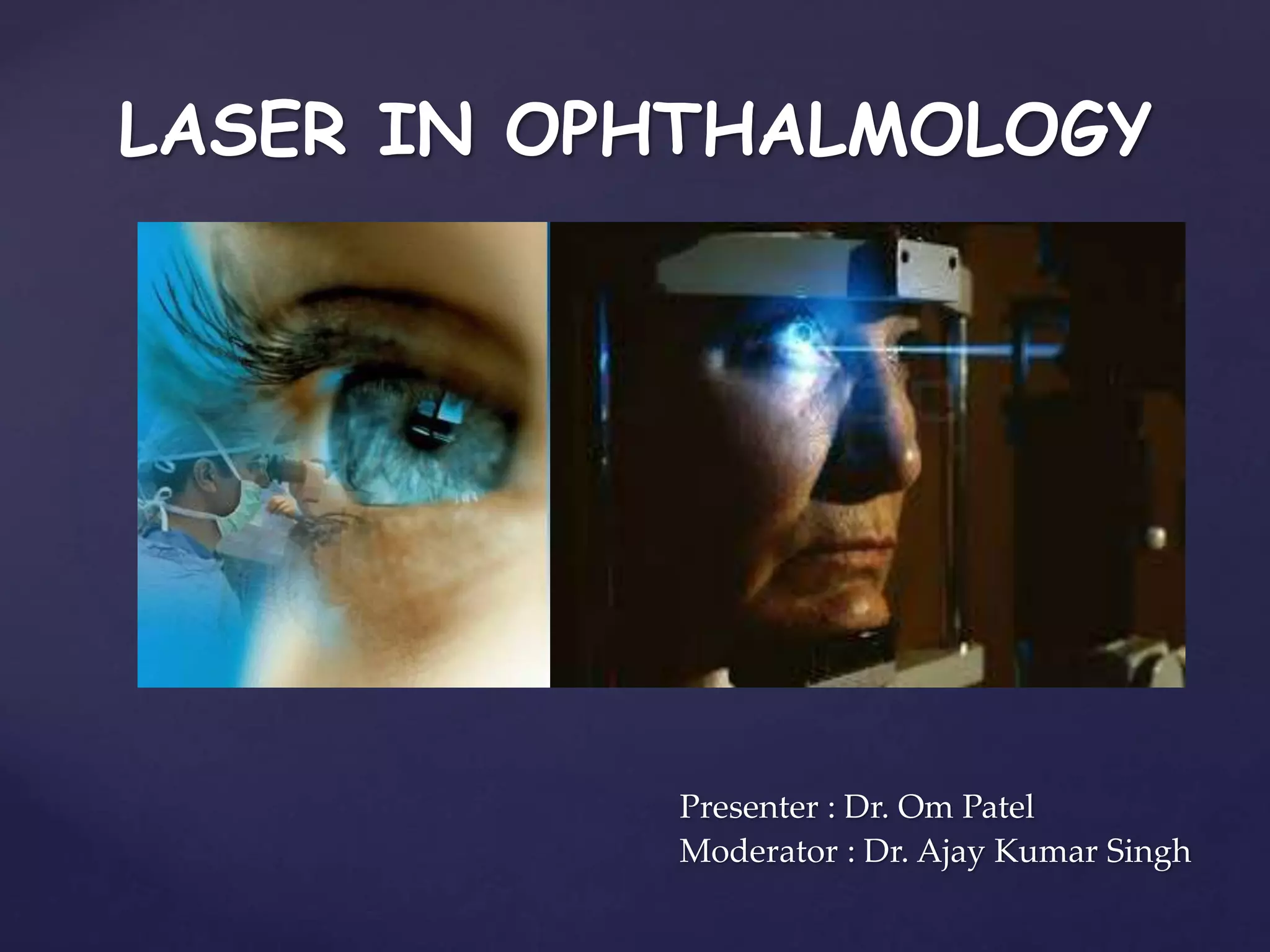 Laser in ophthalmology | PPTX