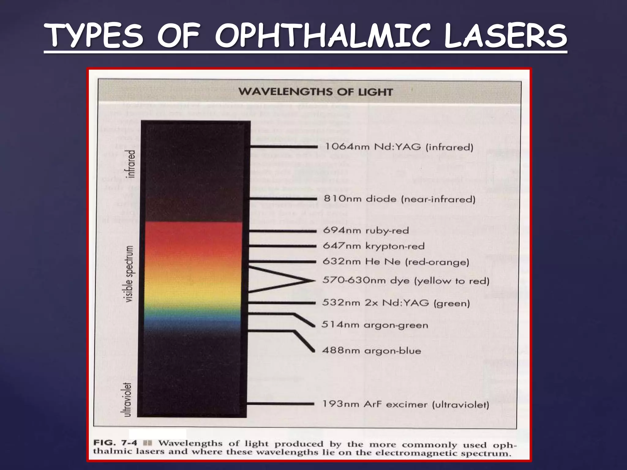 Laser in ophthalmology | PPTX
