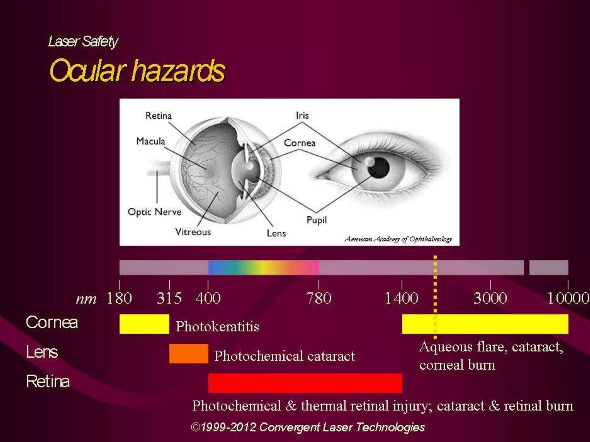 Laser in ophthalmology | PPTX