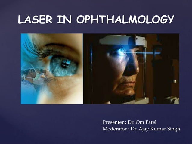 Laser in ophthalmology | PPTX | Eye and Vision Conditions | Diseases ...