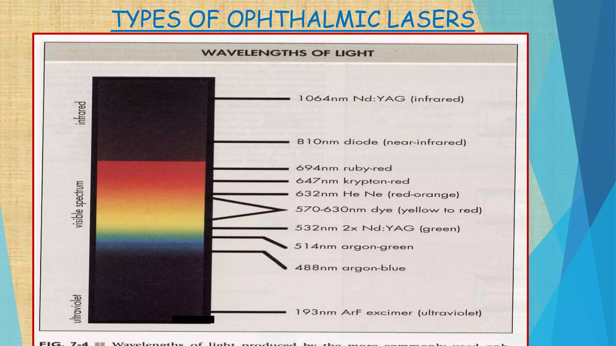 Lasers in ophthalmology | PPTX