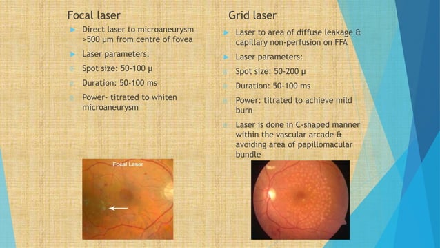 Lasers in ophthalmology | PPTX | Eye and Vision Conditions | Diseases ...