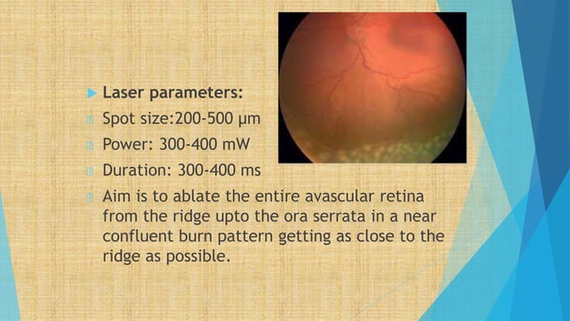 Lasers in ophthalmology | PPTX | Eye and Vision Conditions | Diseases ...