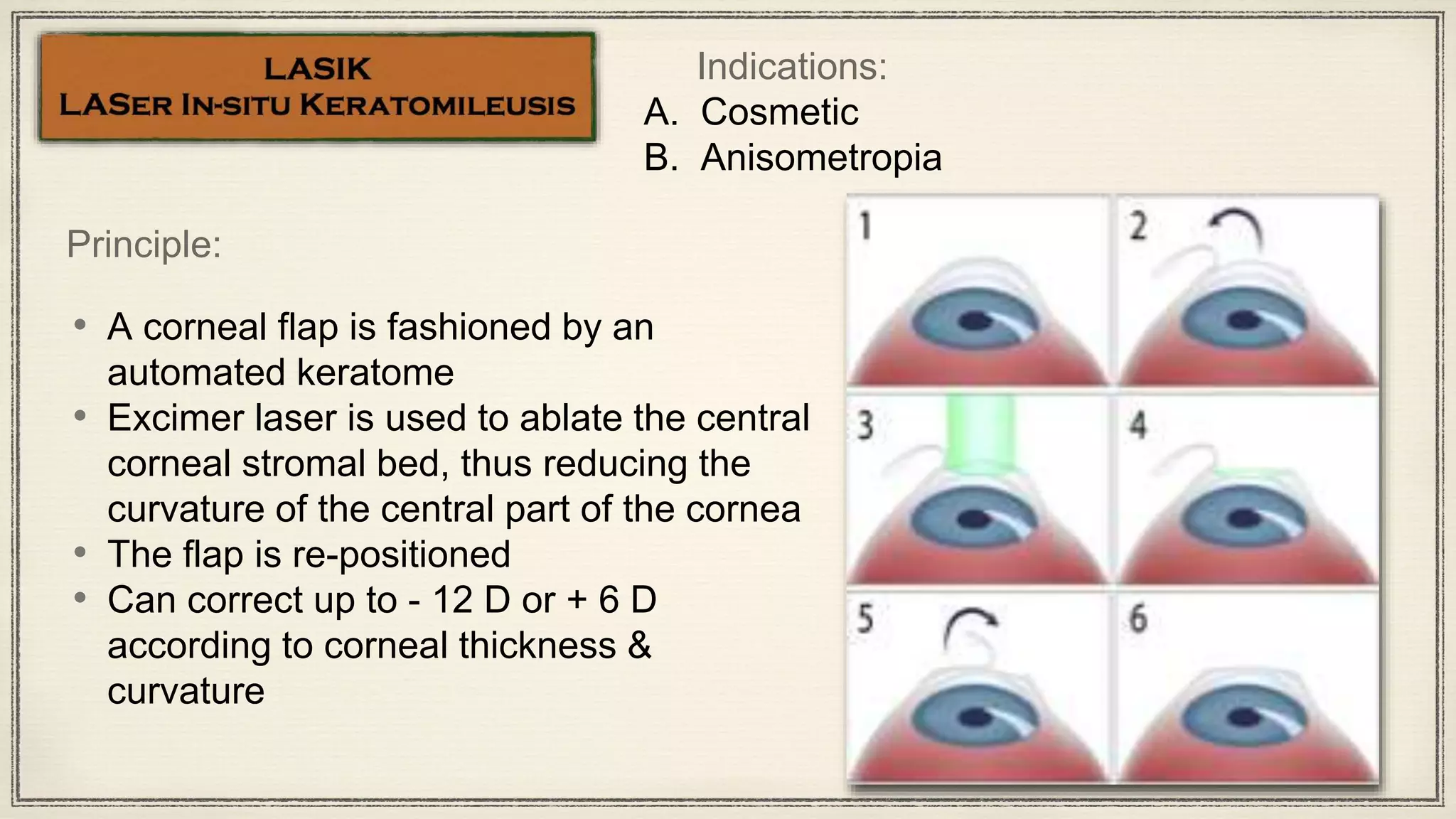 Laser in ophthalmology | PPTX