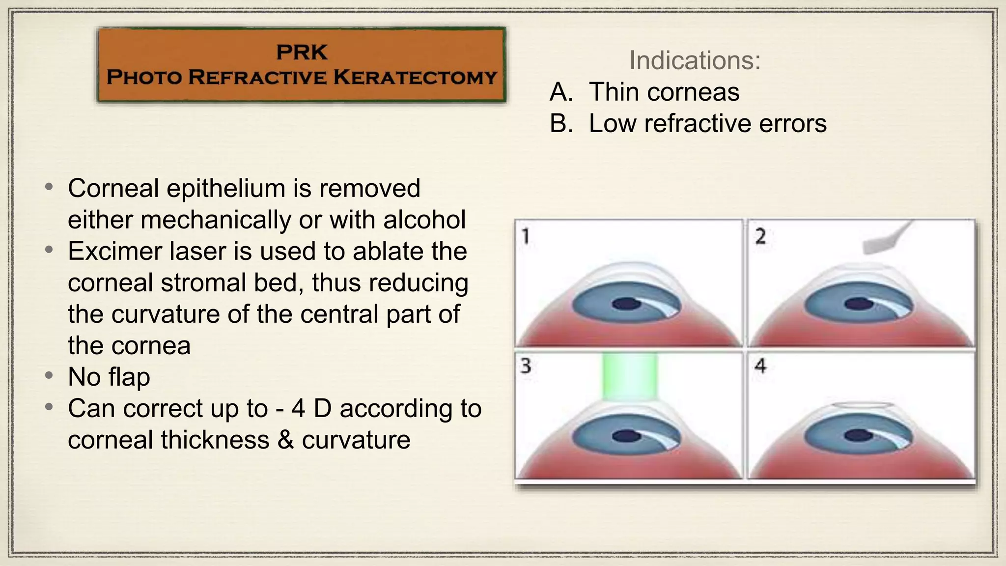 Laser in ophthalmology | PPTX