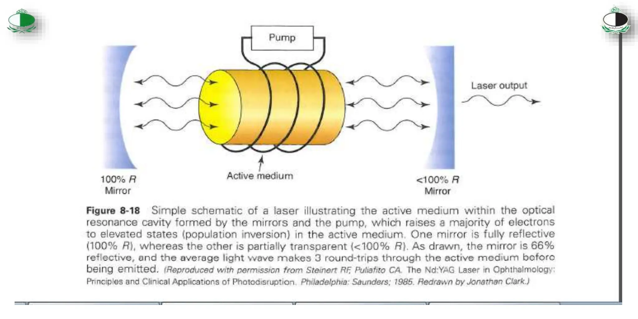Laser in Ophthalmology and types of Laser | PPTX