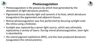 Laser in Ophthalmology and types of Laser | PPTX