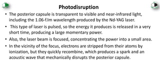 Laser in Ophthalmology and types of Laser | PPTX