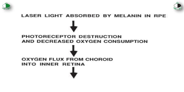 Laser in Ophthalmology and types of Laser | PPTX