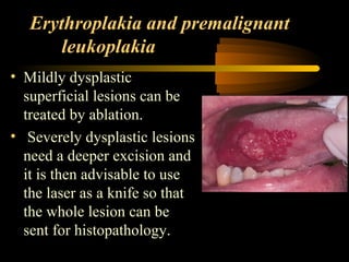 Laser in oral and maxilbfacial surgery | PPT