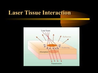 Laser in oral and maxilbfacial surgery | PPT