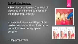 Laser in prosthodontics | PPTX
