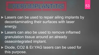 Laser in prosthodontics | PPTX