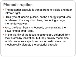 Laser (introduction and indication in posterior segments | PPT