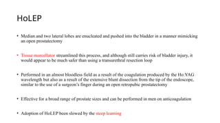Laser in Urology made easy basics .pptx