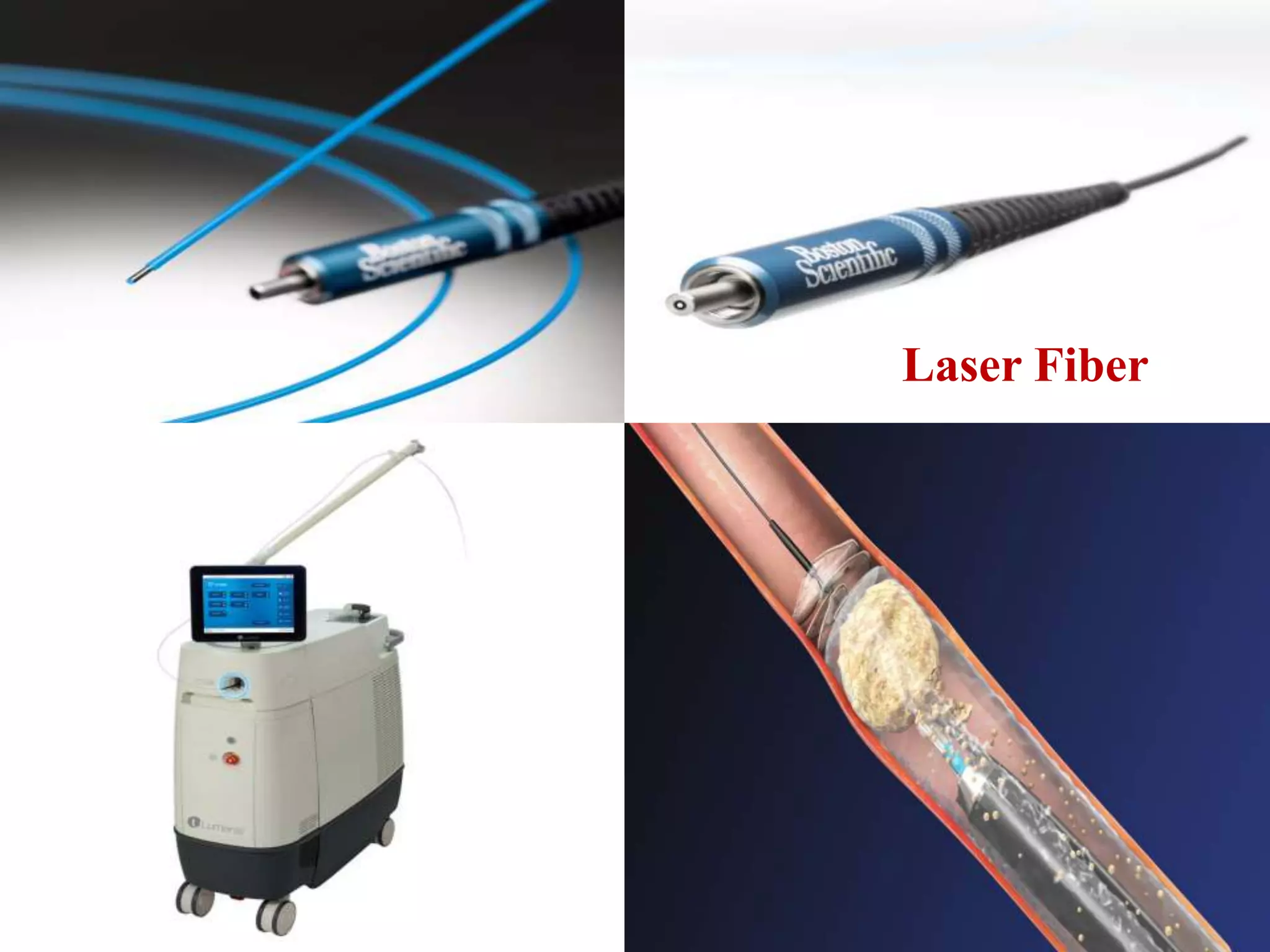 Laser Lithotripsy.pptx