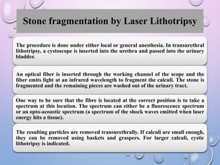 Laser Lithotripsy.pptx