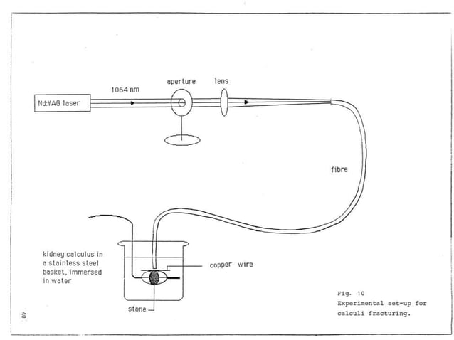 Laser Lithotripsy.pptx