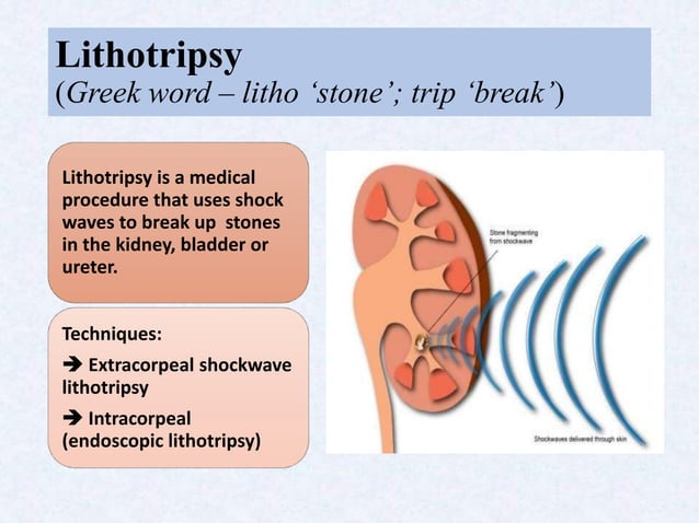 Laser Lithotripsy.pptx