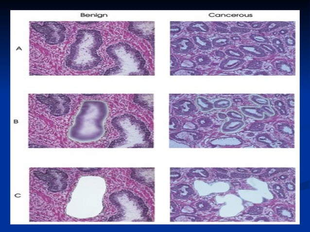 laser microdissection.ppt ORAL PATHOLOGY | PPT