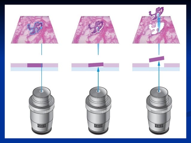 laser microdissection.ppt ORAL PATHOLOGY | PPT