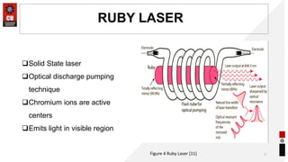 Laser PPT 5 (1).pptx