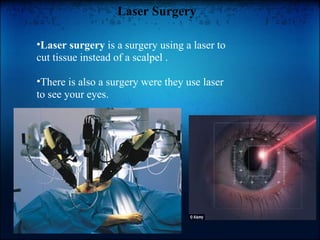 Lasers | PPT