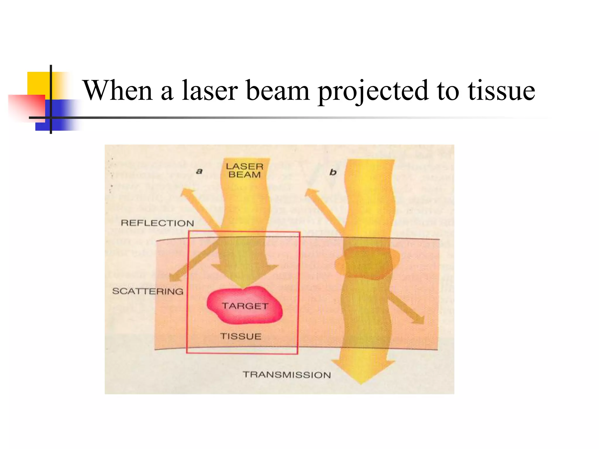 Lasers in surgery | PPTX